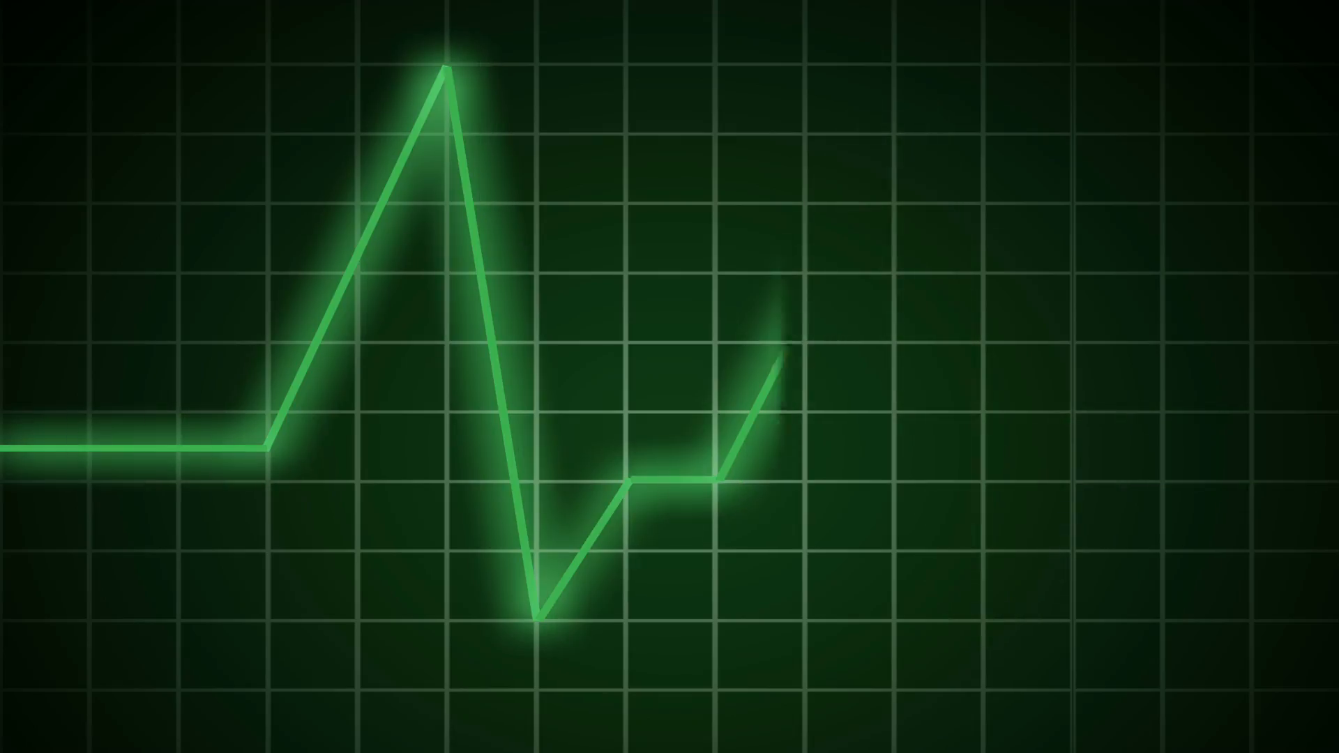 Ekg Ecg Heart Pulse Monitor Loop And Flatline Motion - Light (#647487 ...