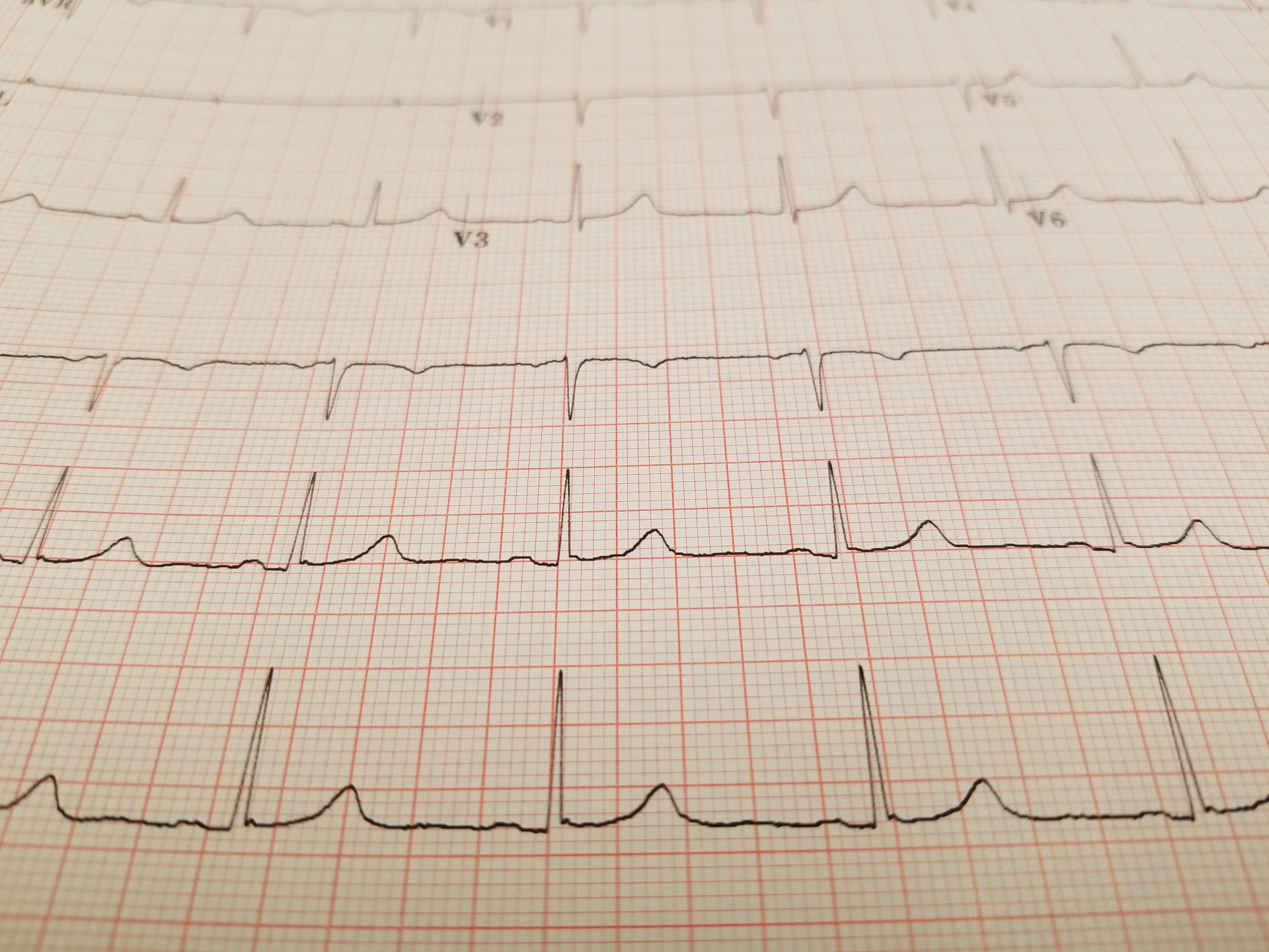 Ecg Test Heart - Paper (#647796) - HD Wallpaper & Backgrounds Download
